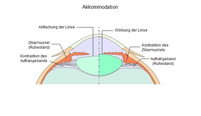 Dictionary page title: Akkomodation | Ihre-Kontaktlinsen.de